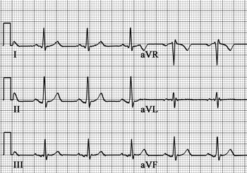 Essential Electrocardiography Cases