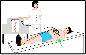 Essential Electrocardiography Cases