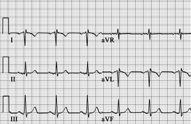 Essential Electrocardiography Cases