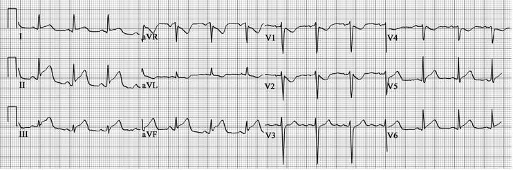 Essential Electrocardiography Cases